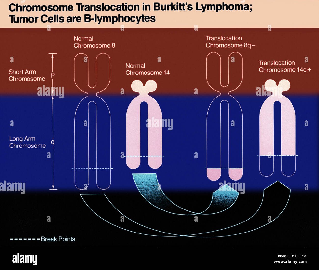 Chromosomes translocation hi-res stock photography and images - Alamy