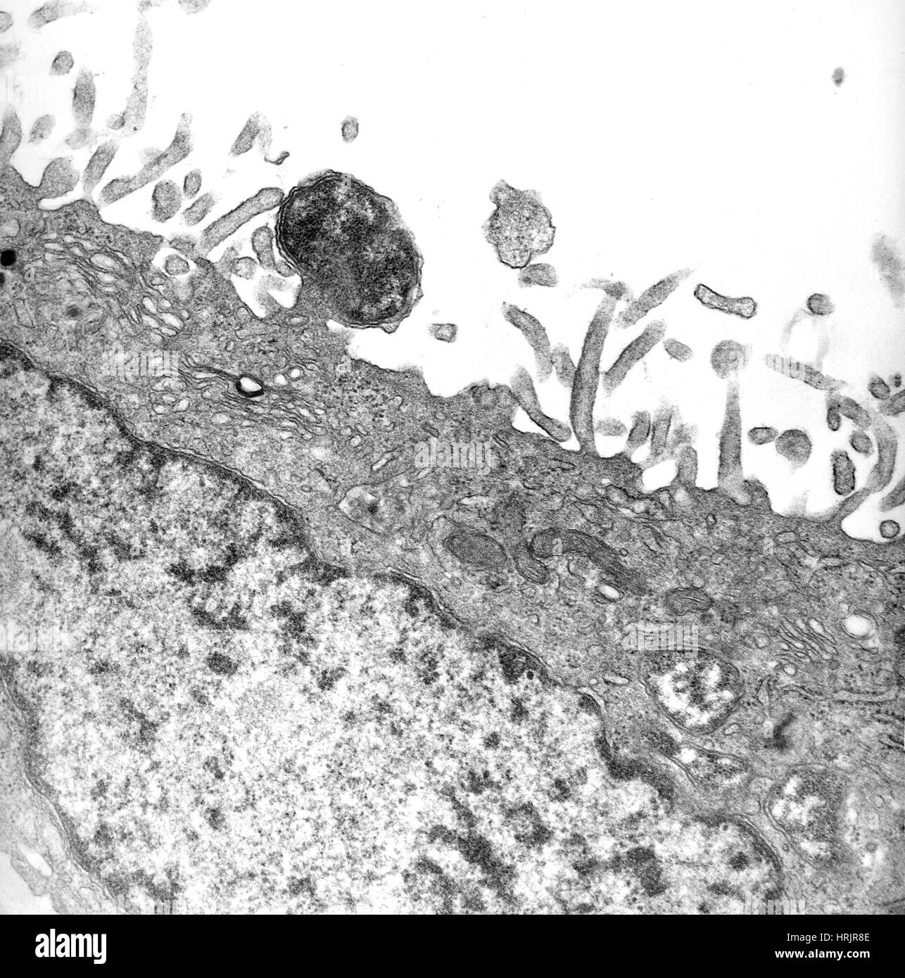 Rickettsia bacteria hi-res stock photography and images - Alamy