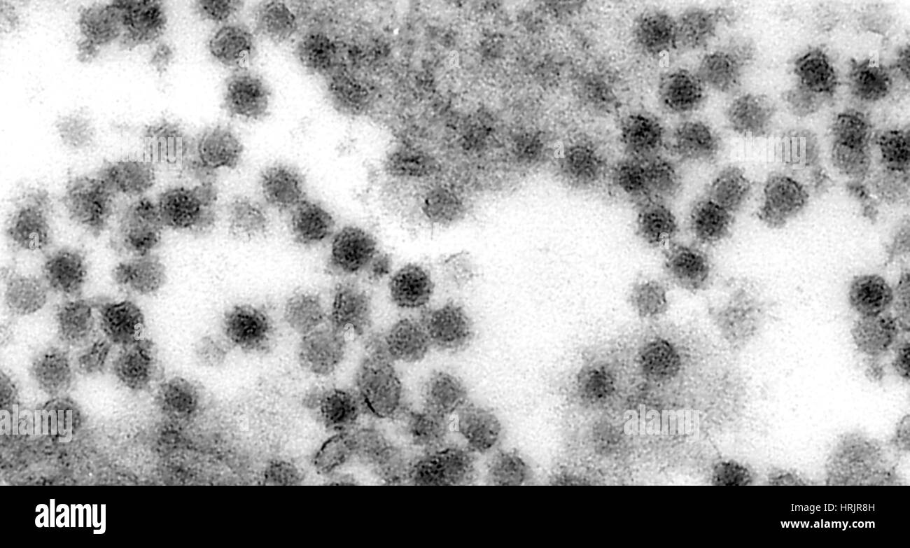 Nile virus Black and White Stock Photos & Images - Alamy