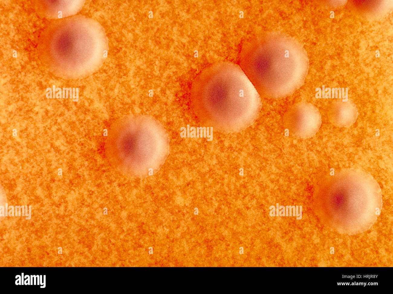 Corynebacterium diphtheriae, Colonial Growth Stock Photo - Alamy