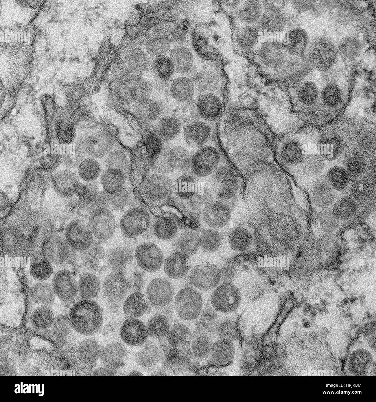 Middle east respiratory syndrome (mers) Black and White Stock Photos ...