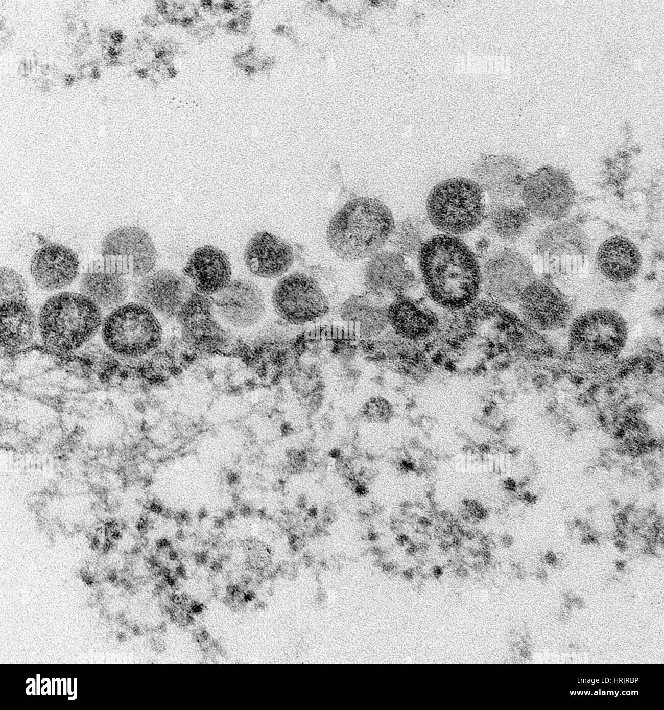 Middle east respiratory syndrome (mers) Black and White Stock Photos ...