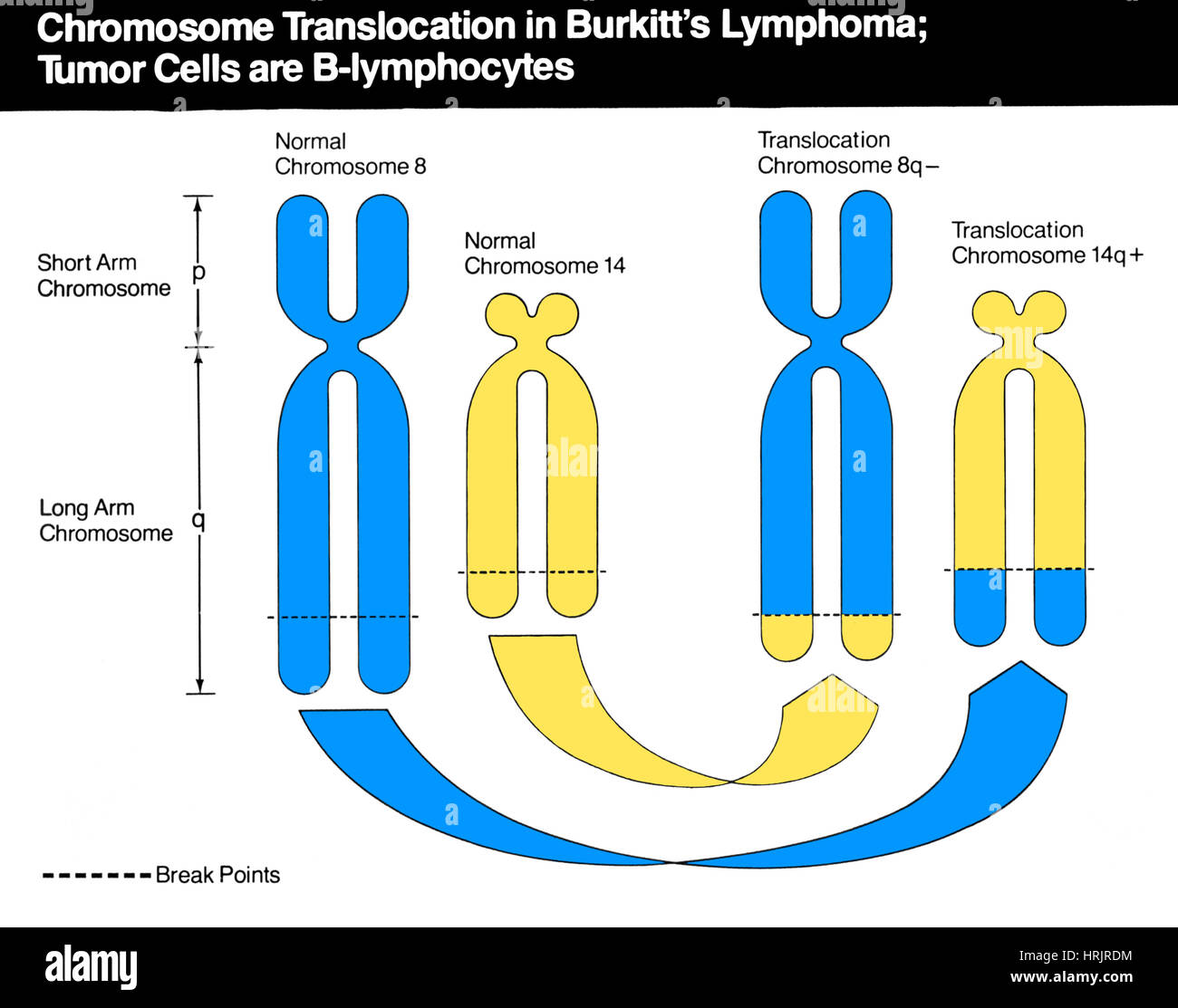 Translocation of chromosomes hi-res stock photography and images - Alamy