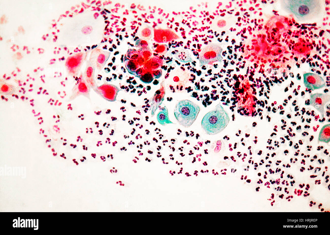 Pap test pap smear hi-res stock photography and images - Alamy