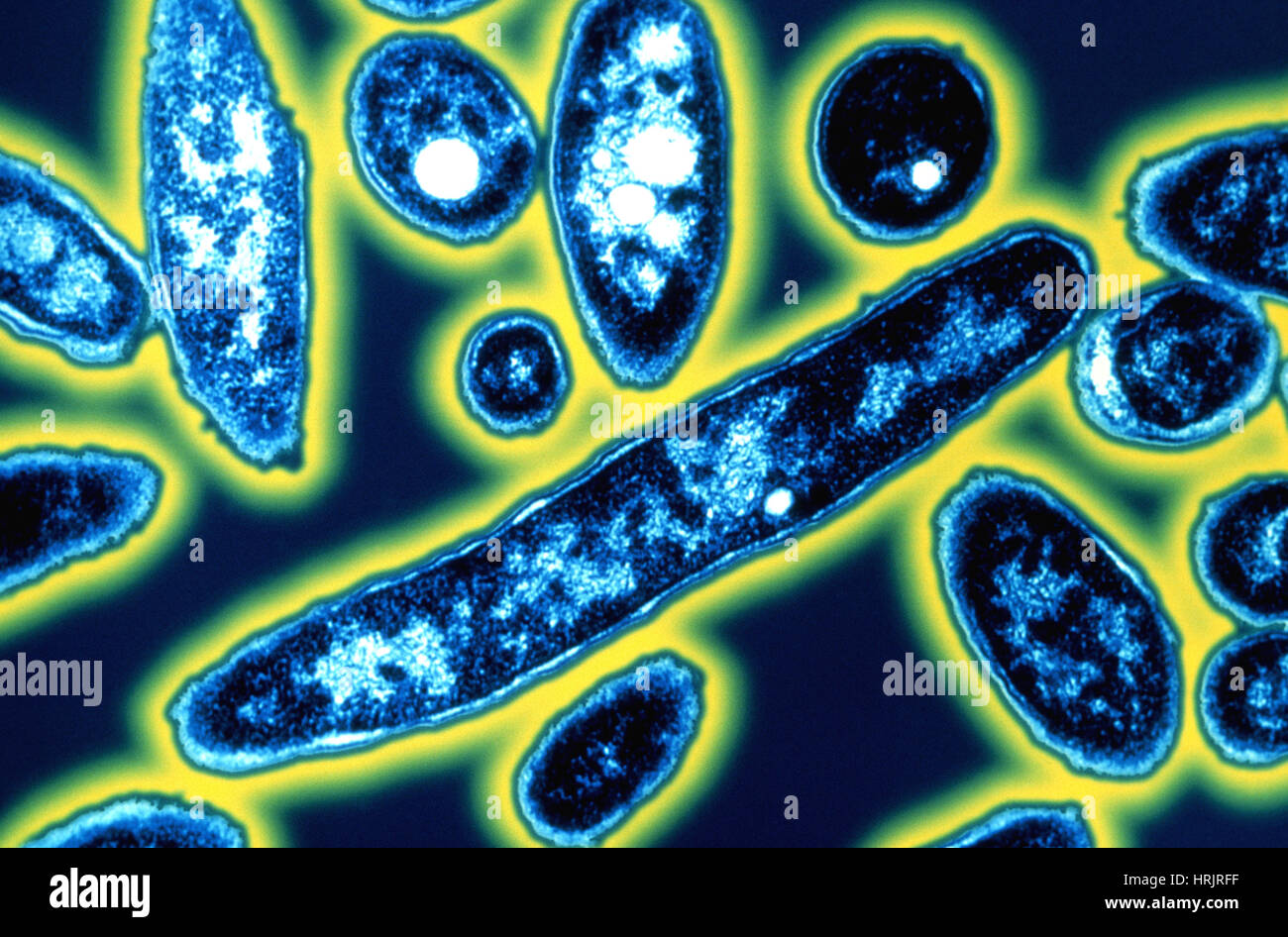 Legionaires disease hi-res stock photography and images - Alamy