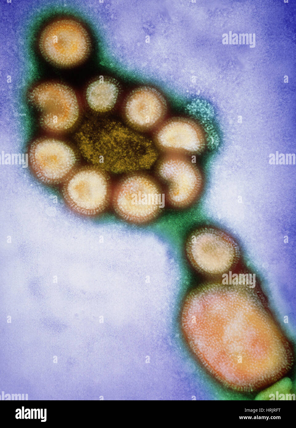 Human influenza virus micrograph hi-res stock photography and images ...