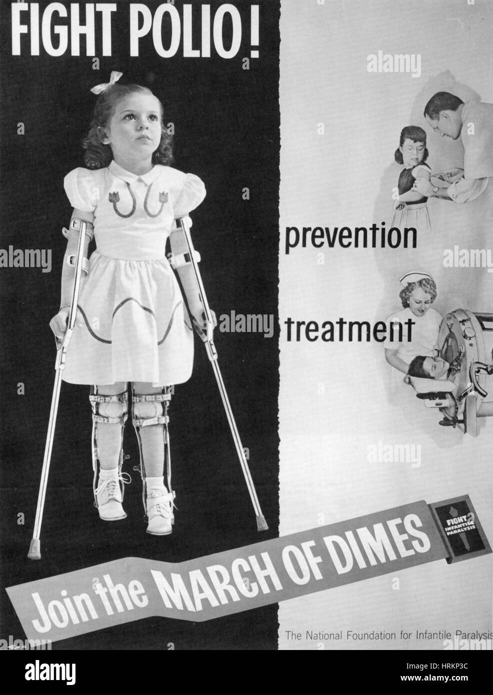 Treatment of polio Black and White Stock Photos & Images - Alamy