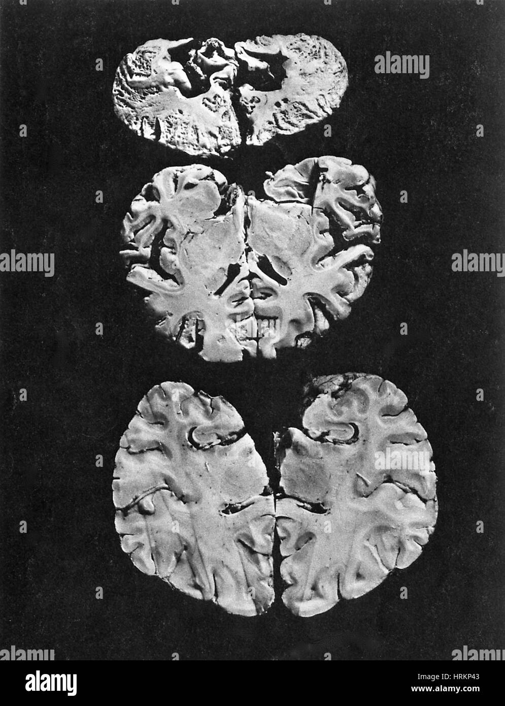 Minamata Disease Stock Photos & Minamata Disease Stock Images - Alamy
