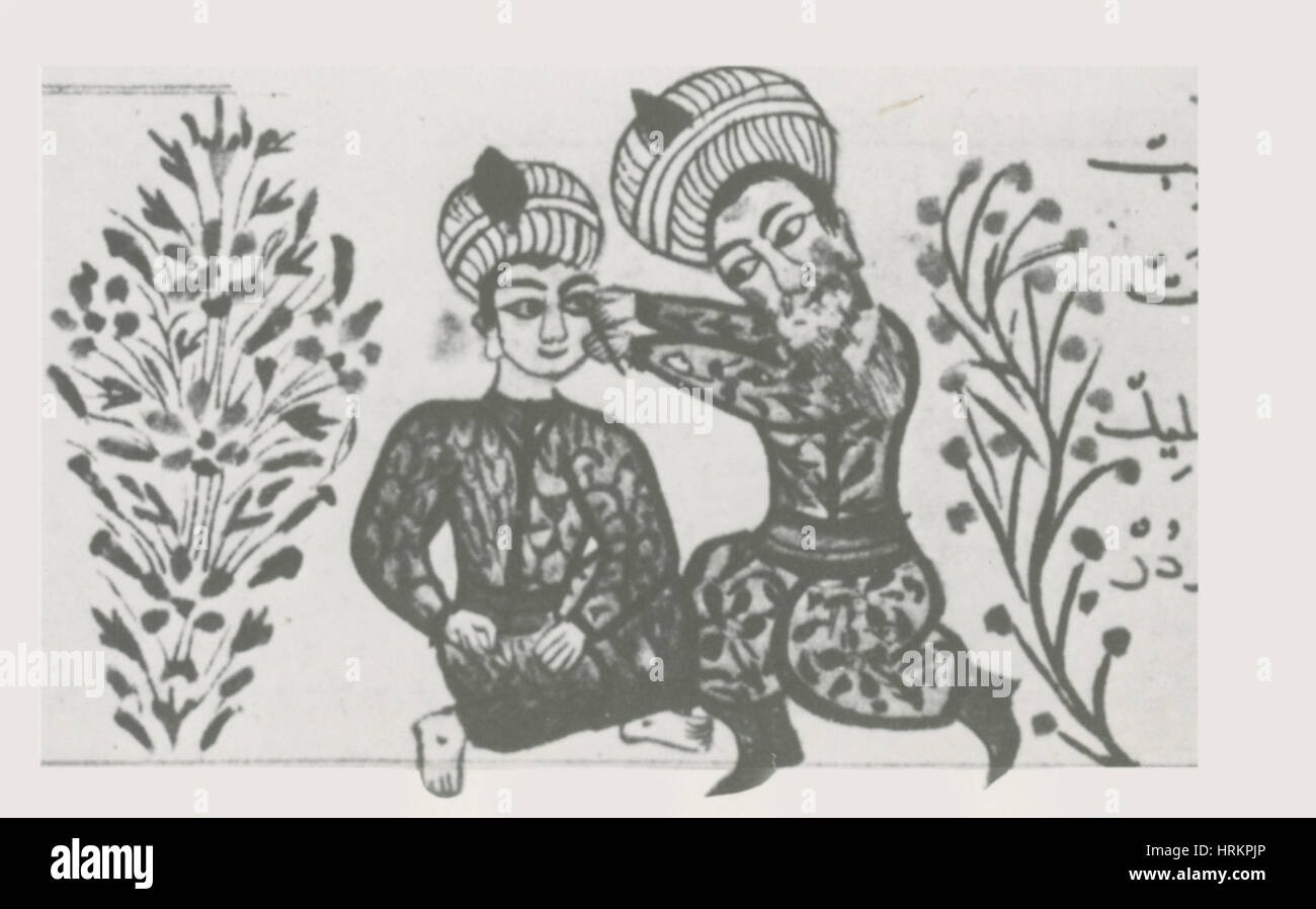 Cataract surgery couching hi-res stock photography and images - Alamy