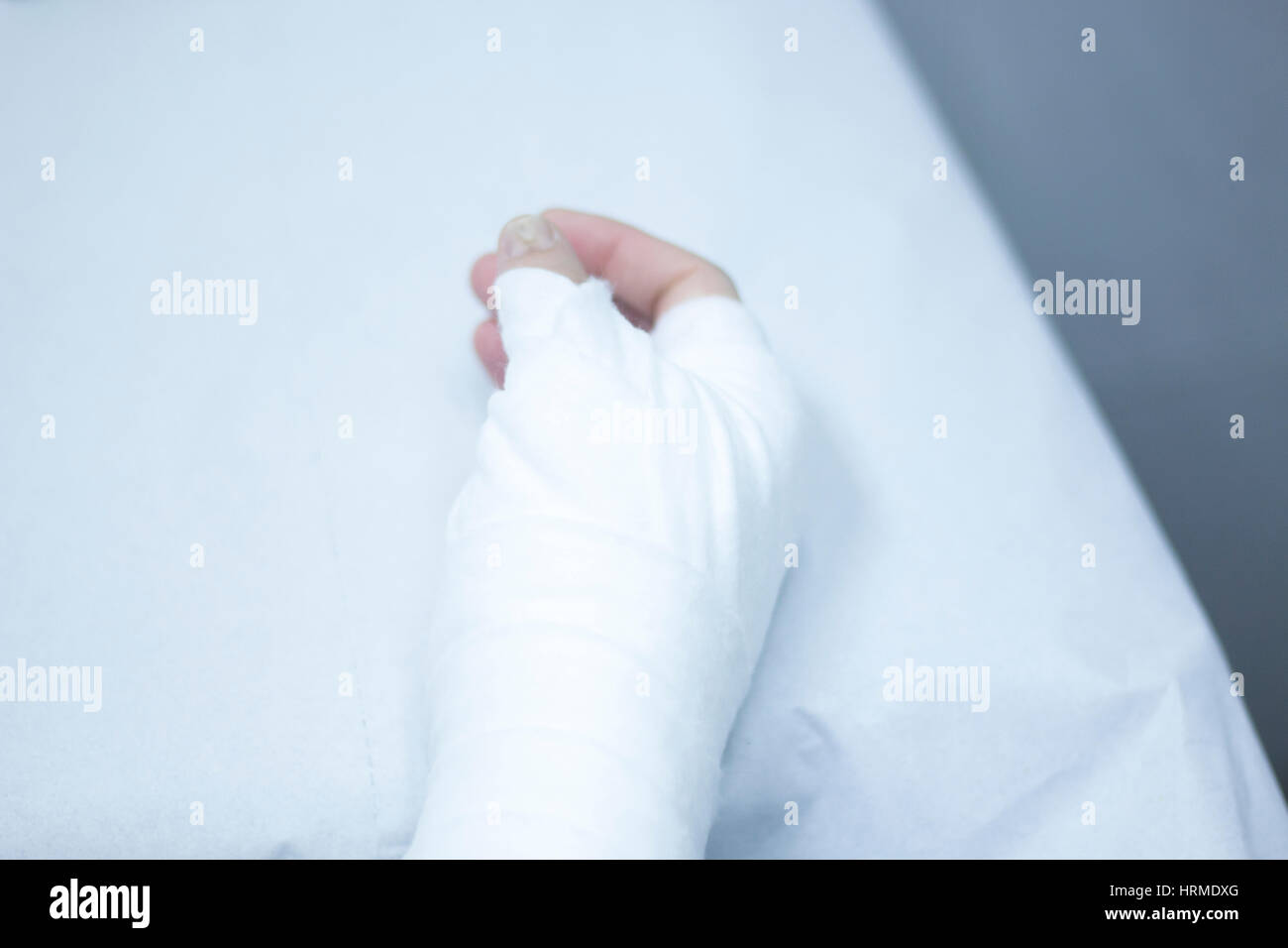 Plaster after wrist fracture hi-res stock photography and images - Alamy