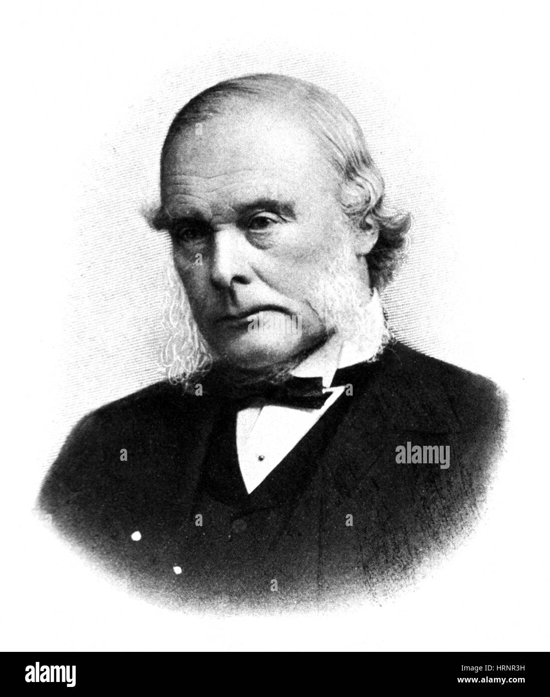Joseph Lister, English Surgeon, Father of Modern Antisepsis Stock Photo ...
