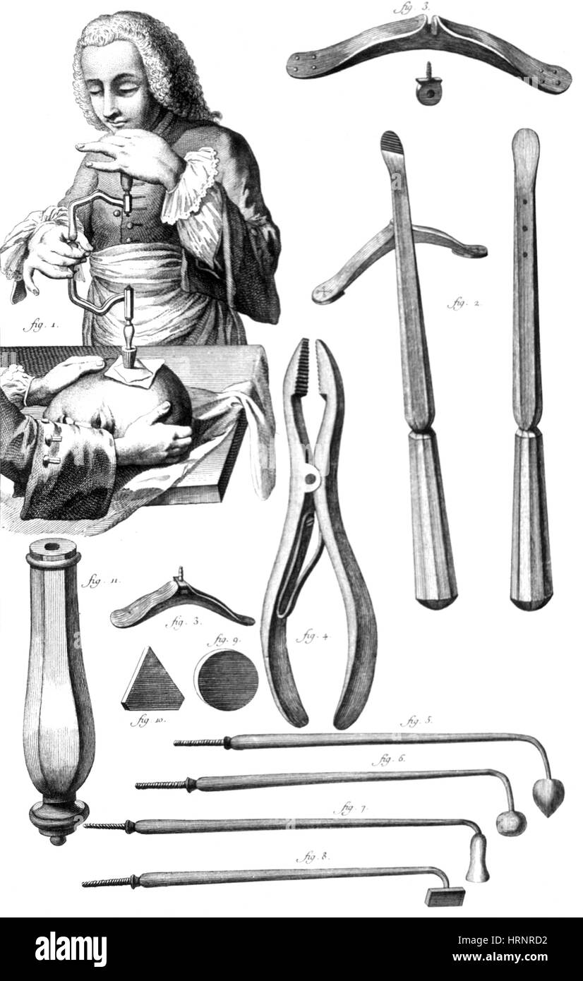 Trepanning operation hi-res stock photography and images - Alamy