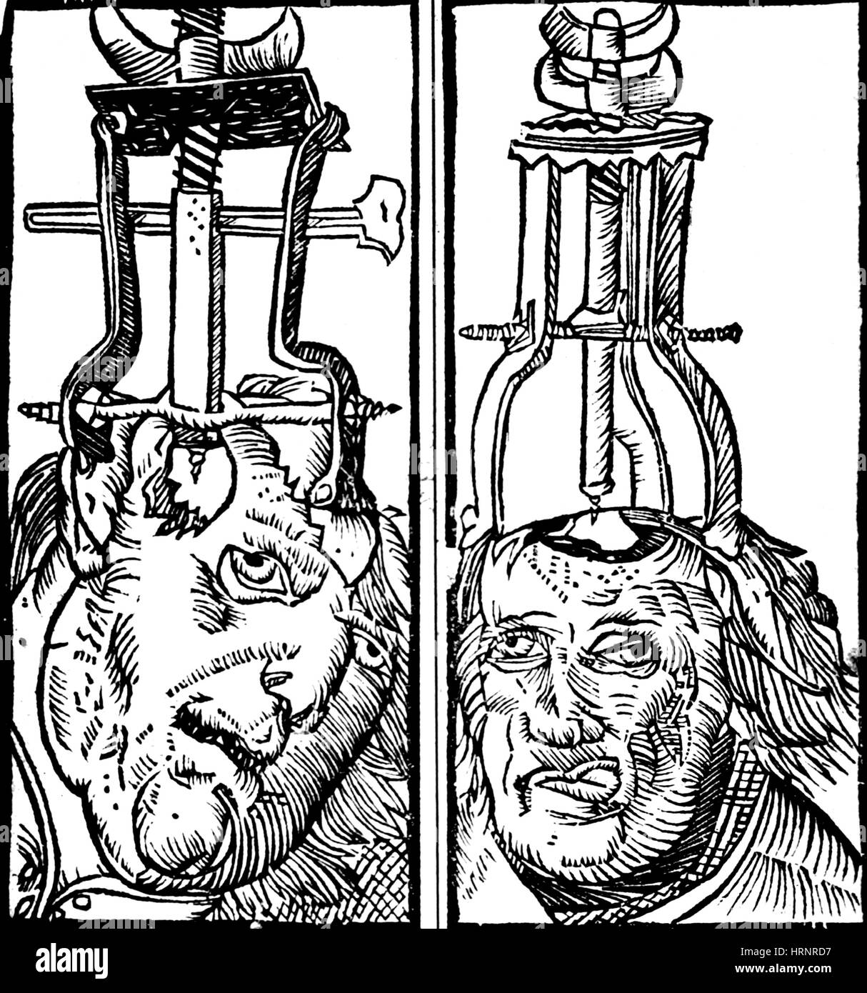 Trepanning operation hi-res stock photography and images - Alamy