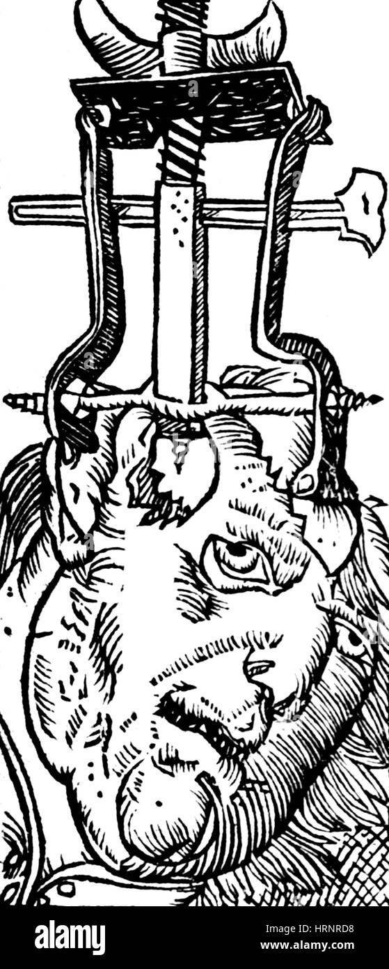 Trepanning High Resolution Stock Photography and Images - Alamy