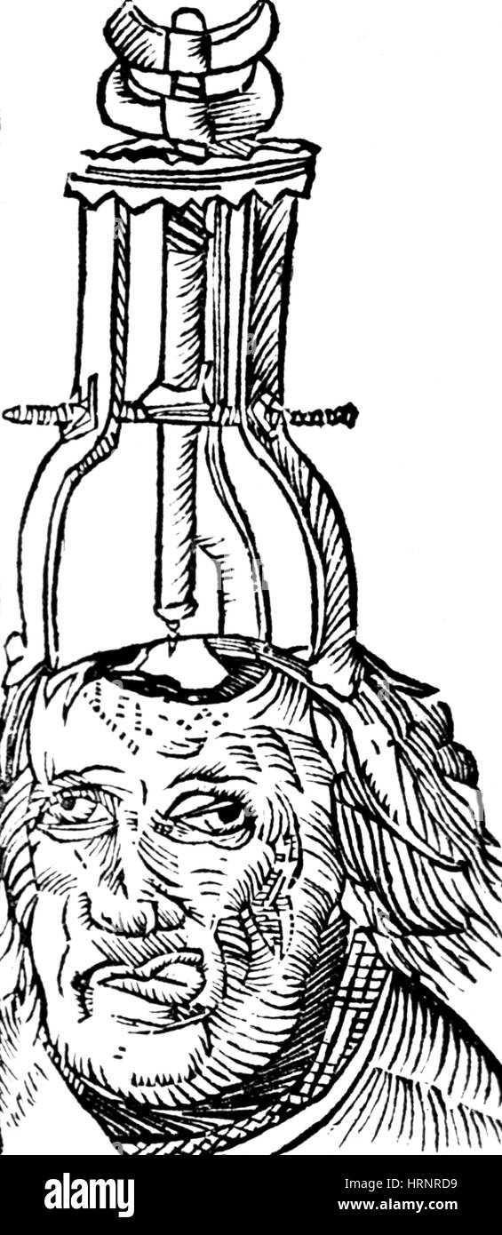 Trepanning Operation High Resolution Stock Photography and Images - Alamy