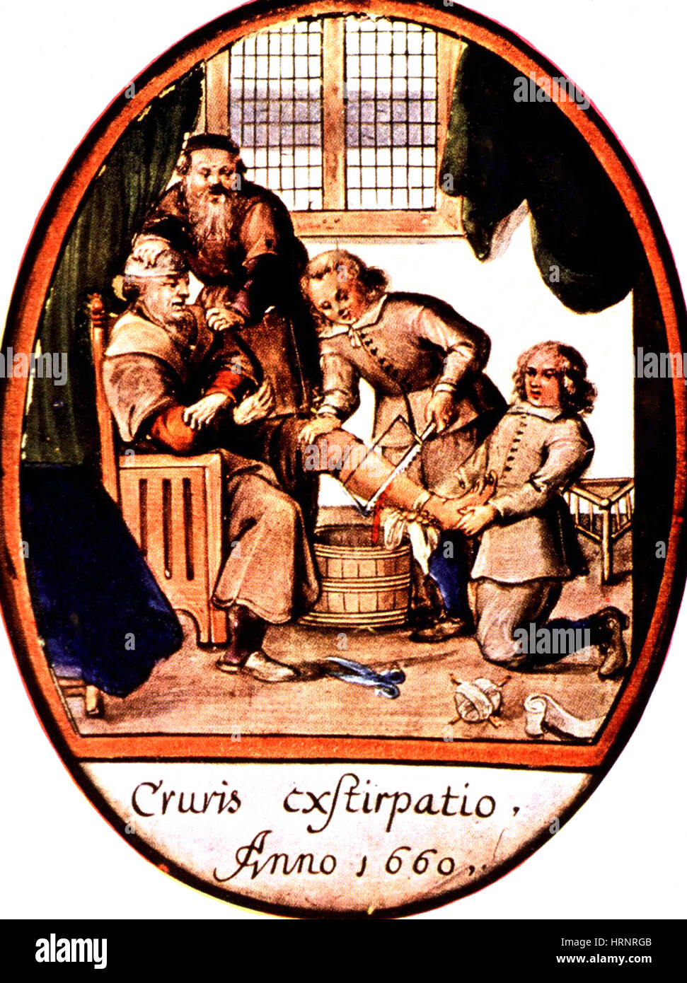 Amputation Saw High Resolution Stock Photography and Images - Alamy