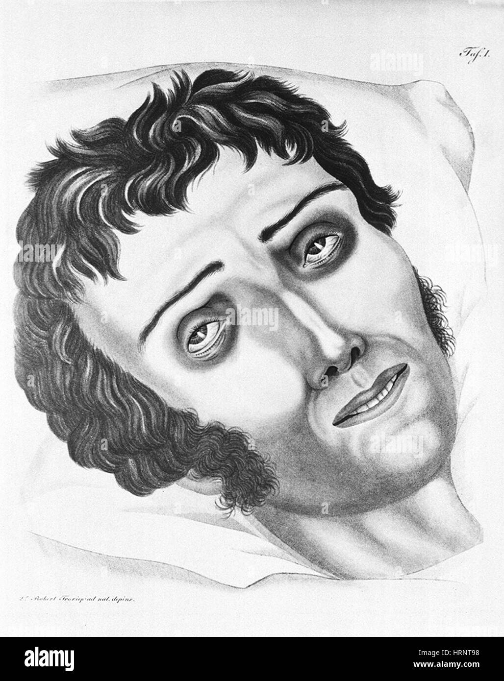 19th century cholera patient hi-res stock photography and images - Alamy