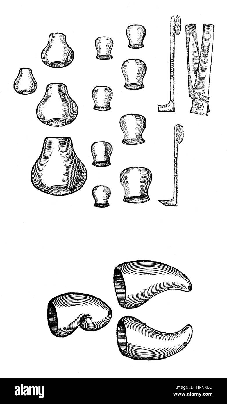 Cupping Vessels, 16th Century Stock Photo - Alamy