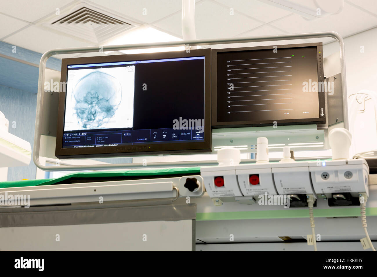 Human head X-ray image on a computer monitor in a new neurosurgery room ...