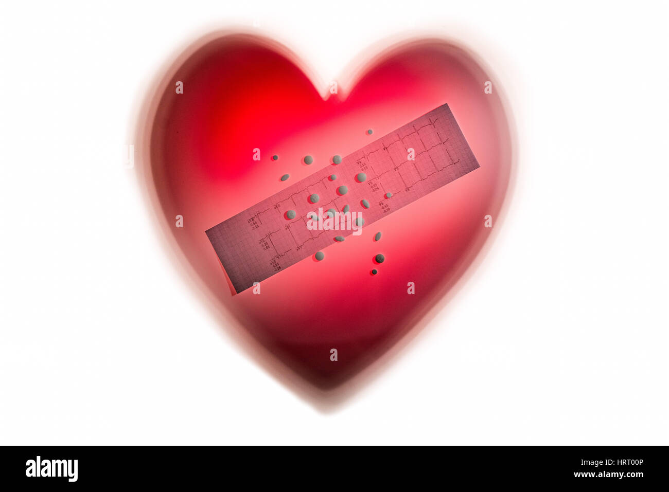 Heart failure electrocardiogram hi-res stock photography and images - Alamy