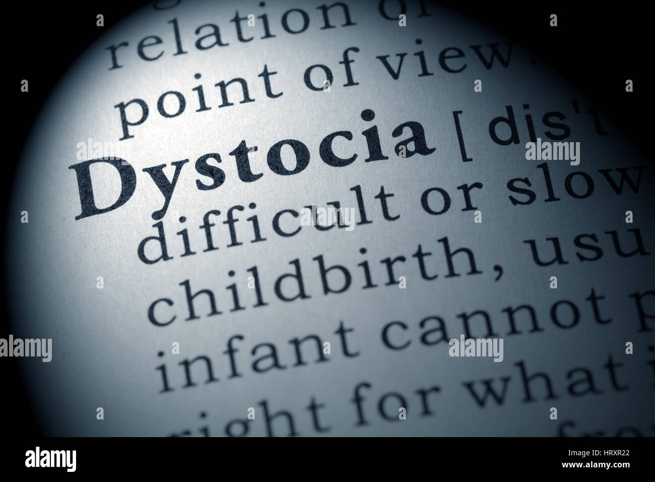 Dystocia hi-res stock photography and images - Alamy