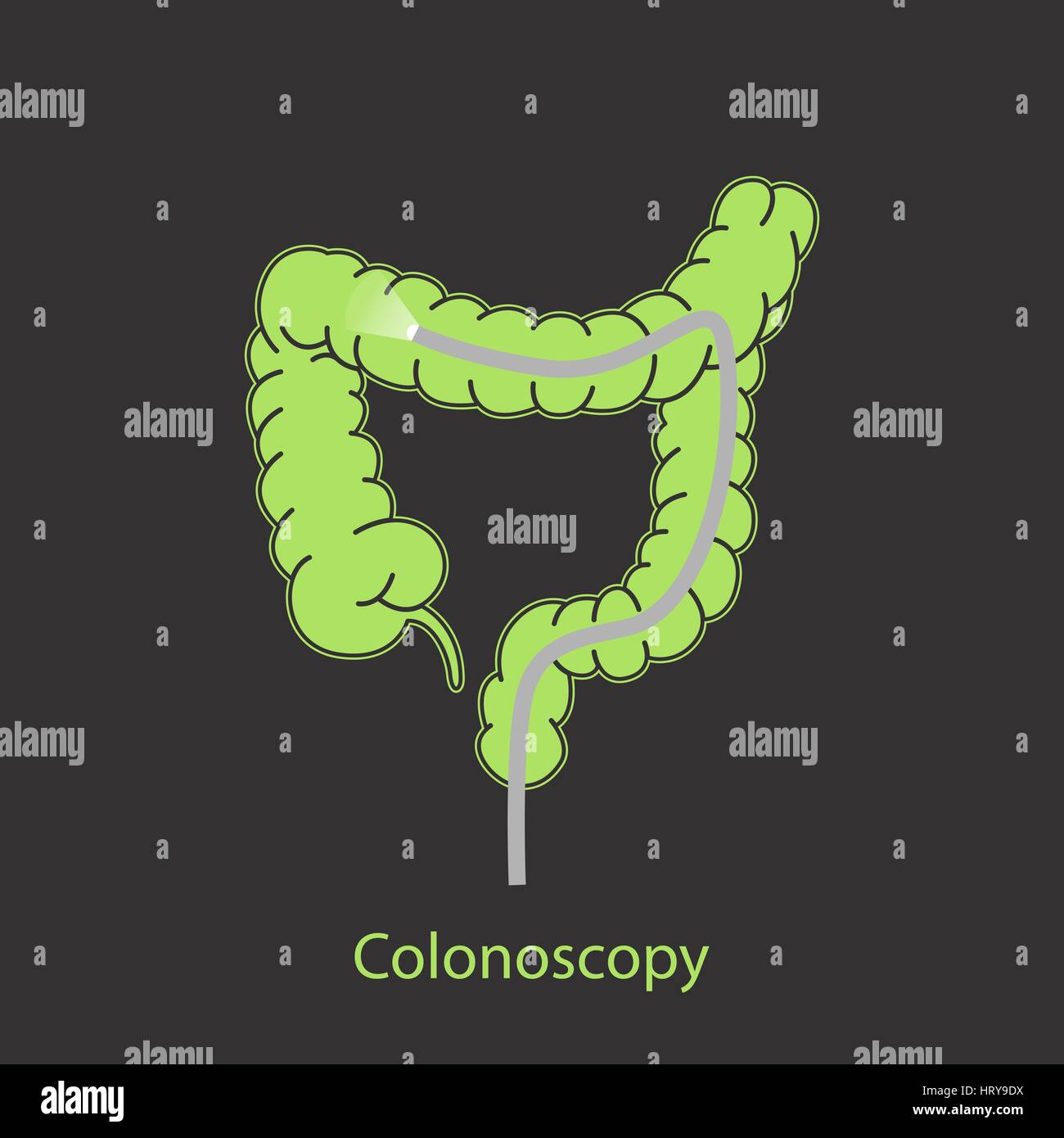 Colonoscope hi-res stock photography and images - Alamy