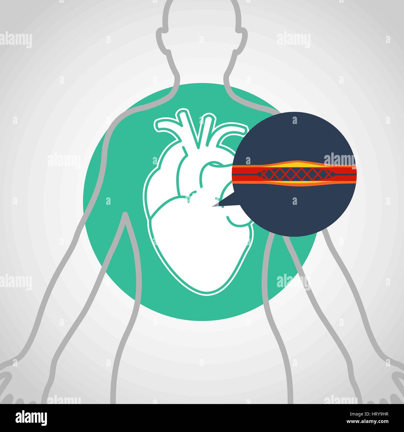 Cardiac Catheterization Stock Photos & Cardiac Catheterization Stock ...