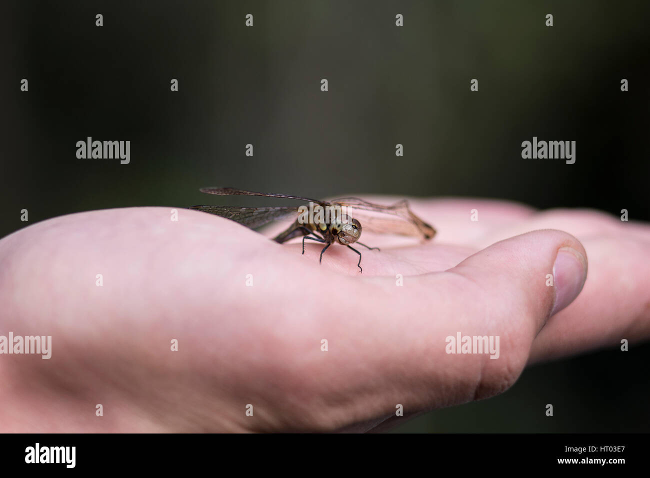 Injured hand hi-res stock photography and images - Alamy