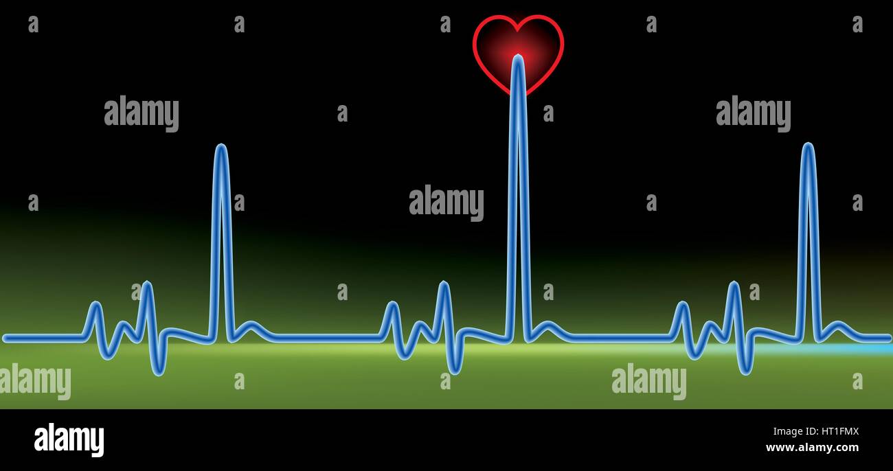 Monitor with heart beat Stock Vector Image & Art - Alamy