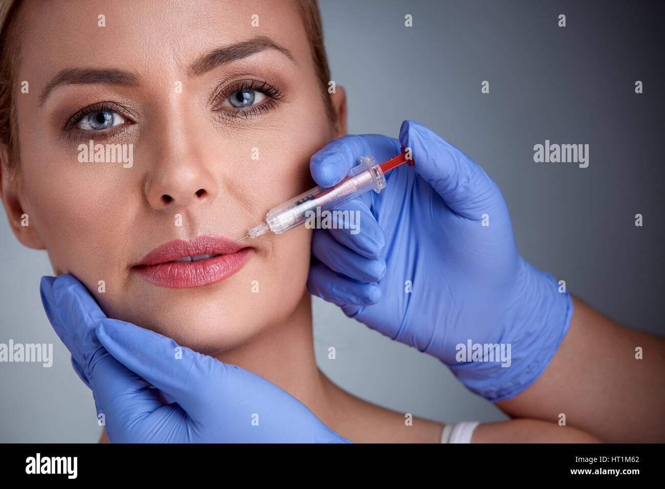 Woman having injection of botox in lips, beauty treatment Stock Photo ...