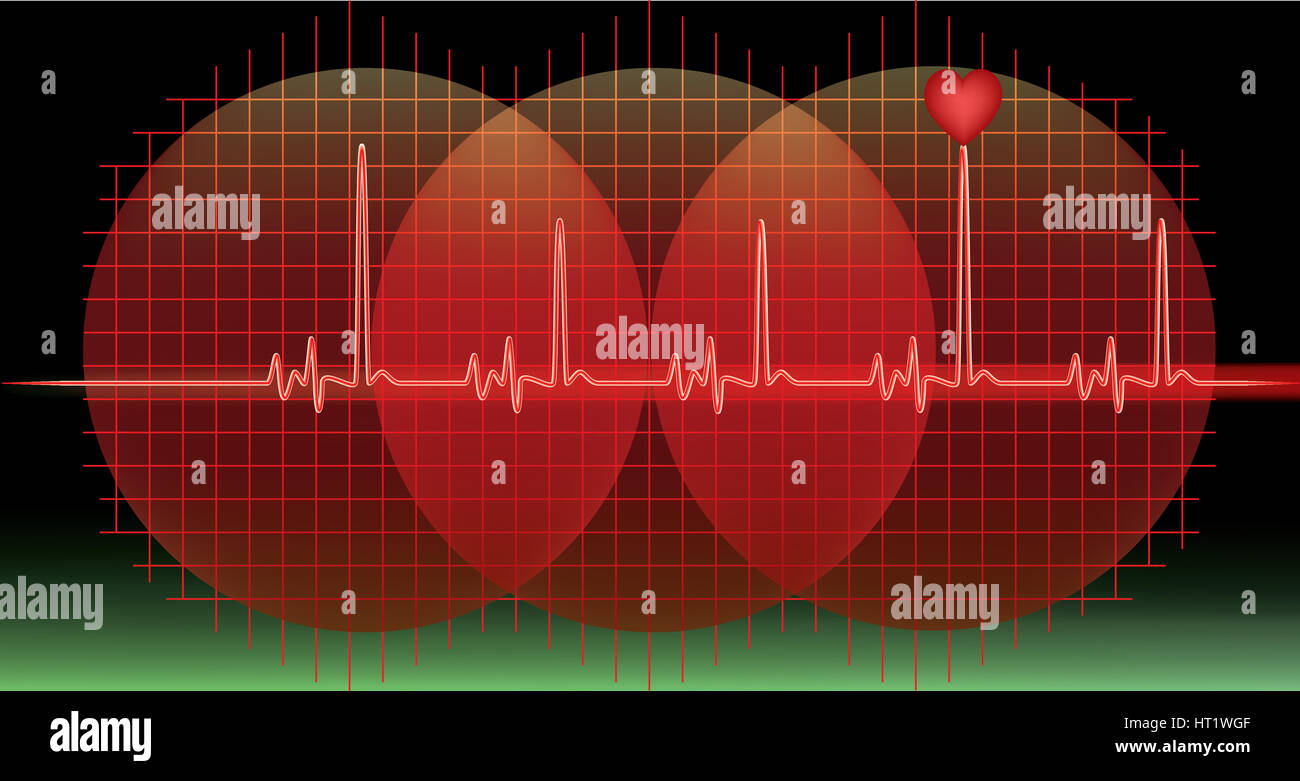 Heart monitor screen hi-res stock photography and images - Alamy