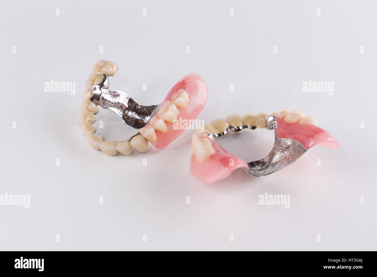 Clasp prosthesis with and attachments fixing ceramic crowns Stock Photo ...