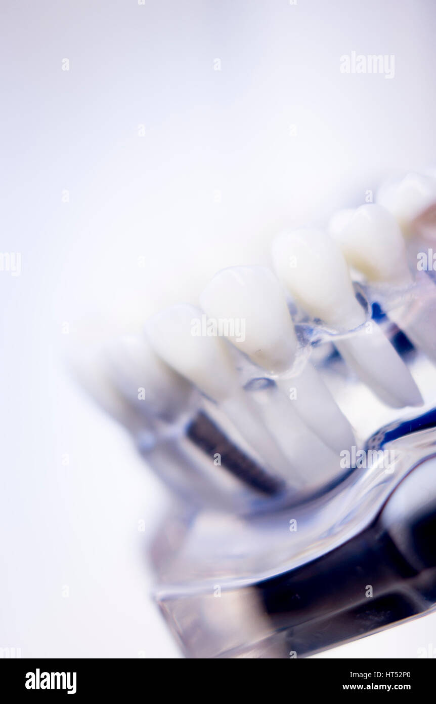 Dentists tooth plastic model used for teaching, learning and patient ...