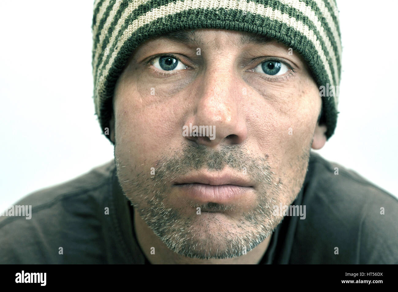 Portrait of a man with swollen face suffering from toothache Stock ...