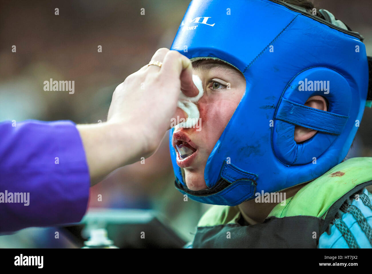 Bloody Nose High Resolution Stock Photography and Images - Alamy