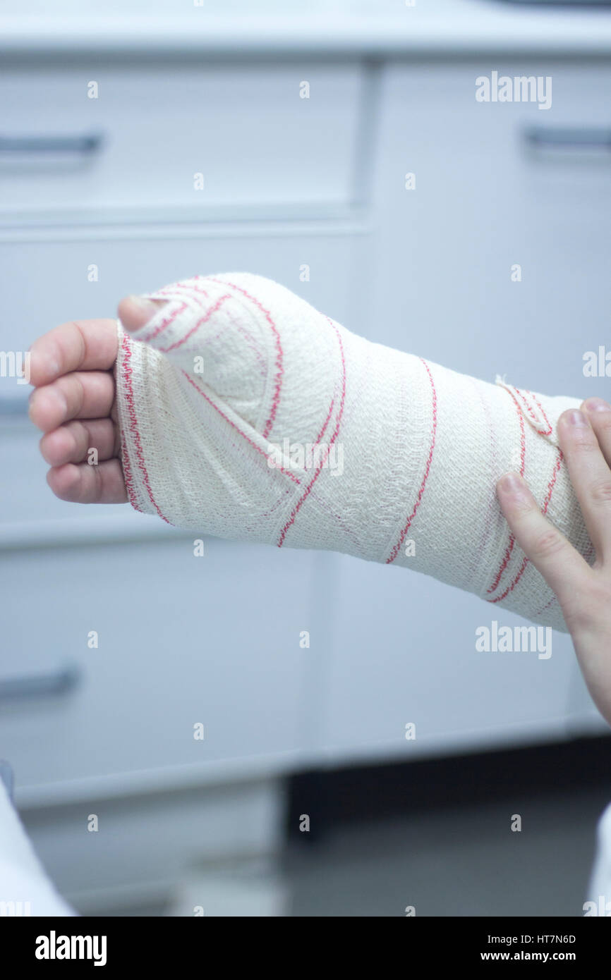 Doctor applying a plaster cast and bandages to patient forearm and ...
