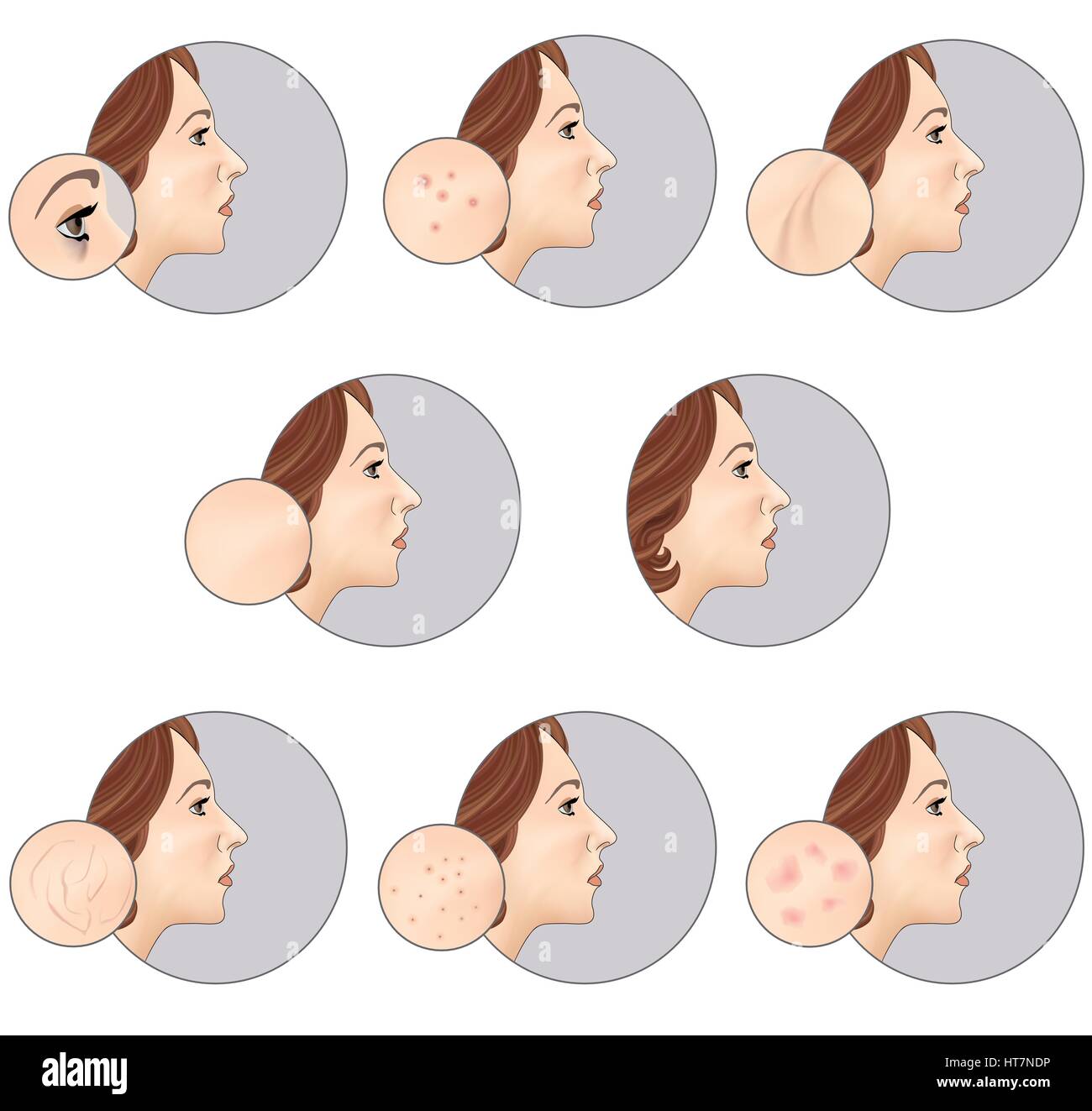 Skincare label vector set. Woman's skin before and after the procedure ...