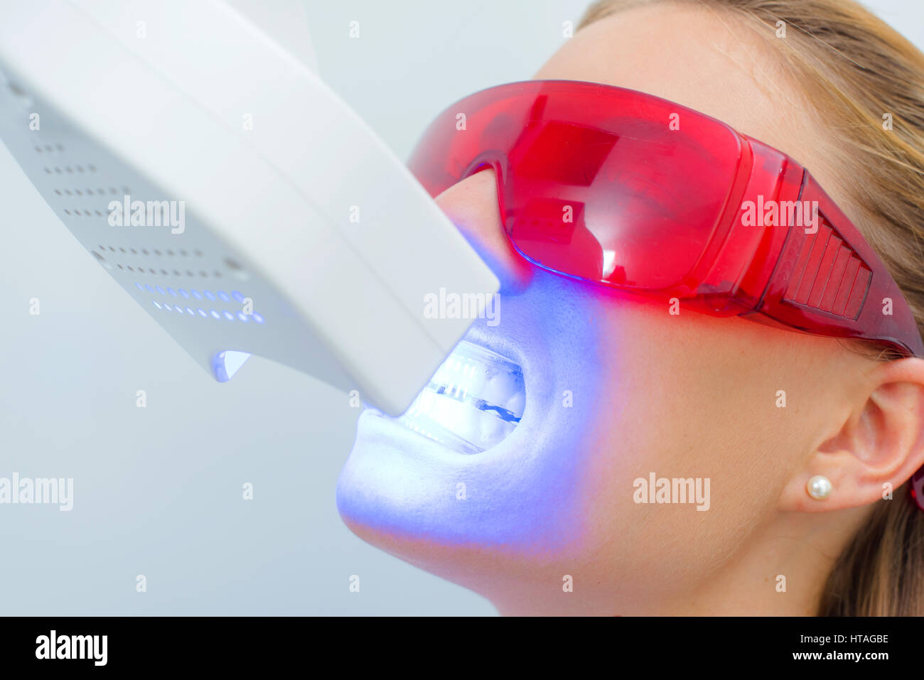 In the middle of getting her teeth whitened Stock Photo - Alamy