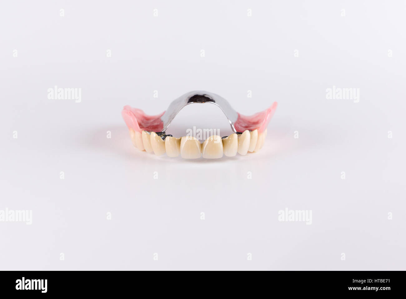 Clasp prosthesis with and attachments fixing ceramic crowns Stock Photo ...