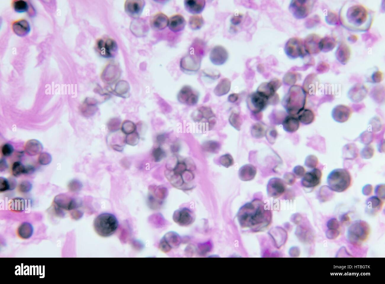 Protothecosis hi-res stock photography and images - Alamy