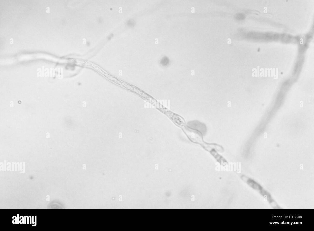 The algae Prototheca filamenta, which resembles a fungal organism due ...