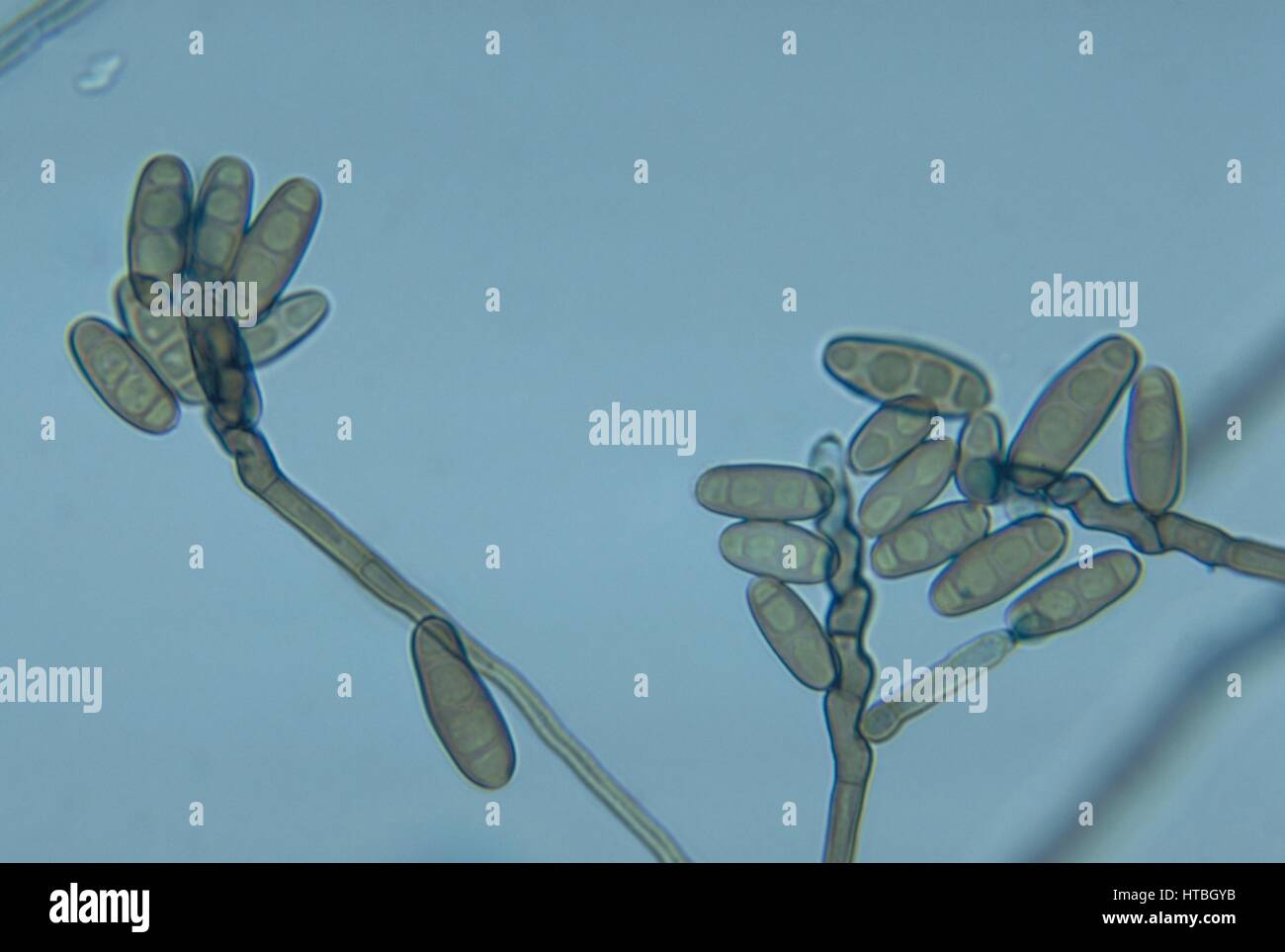 Photomicrograph of conidiophores and conidia of the fungus Curvularia ...