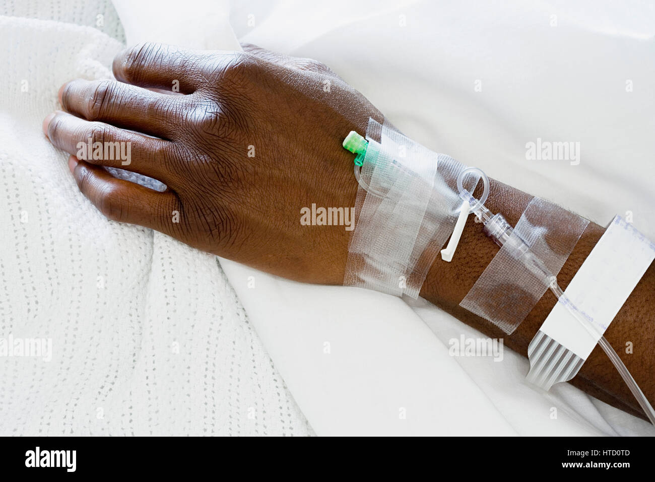 Arm of patient with drip Stock Photo - Alamy