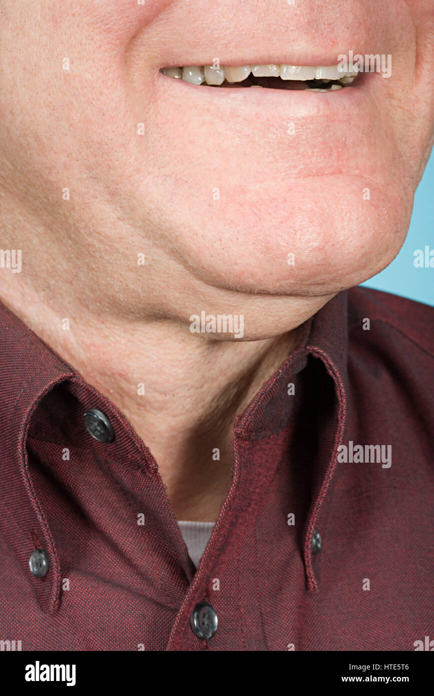 Chin of a man Stock Photo - Alamy