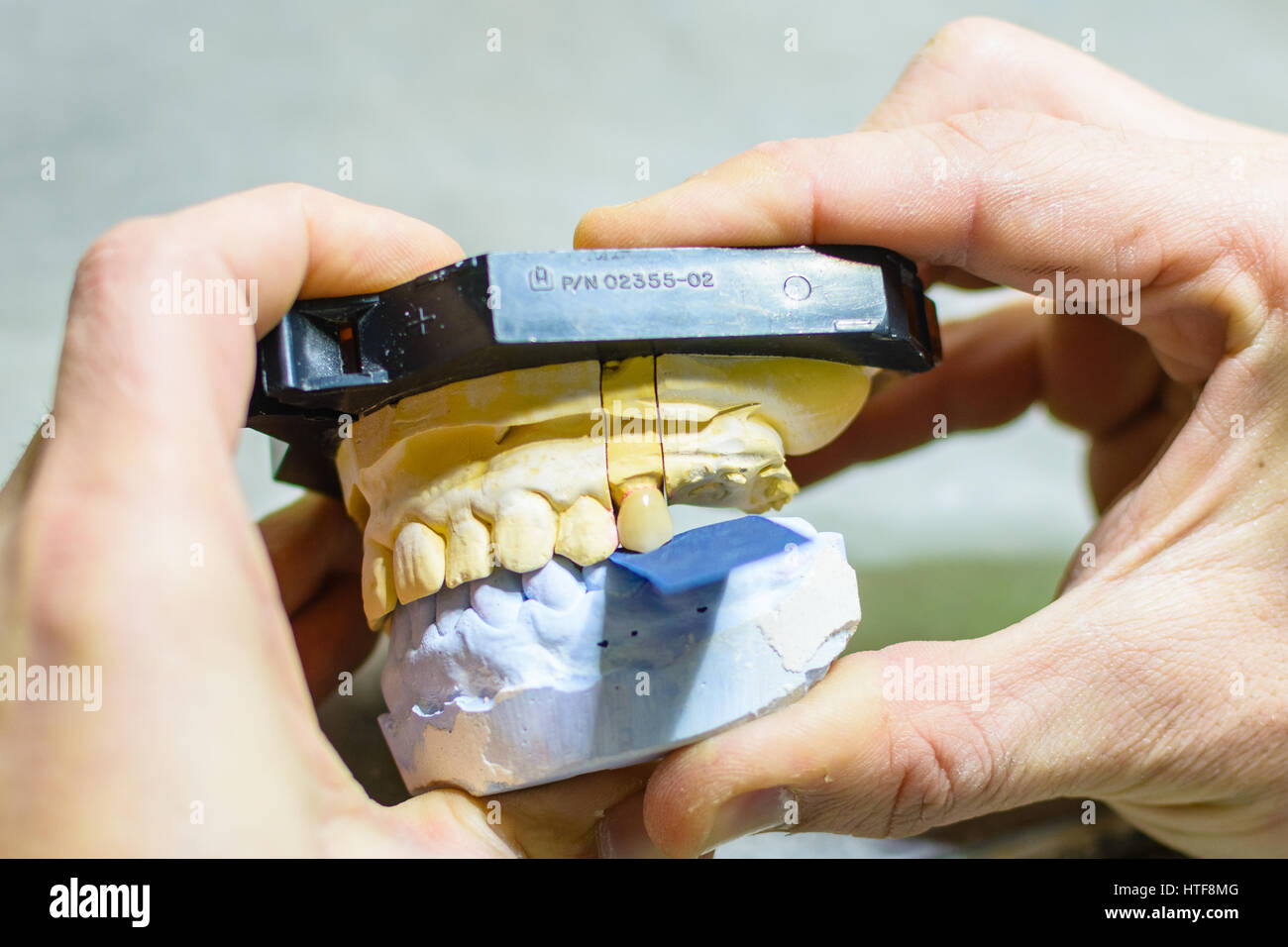 Prosthetic test hi-res stock photography and images - Alamy