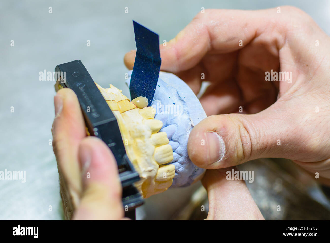 Prosthetic test hi-res stock photography and images - Alamy