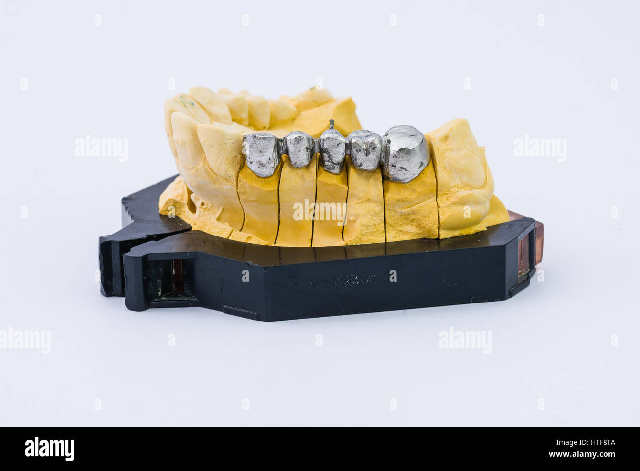 Metal teeth for prosthesis Stock Photo - Alamy