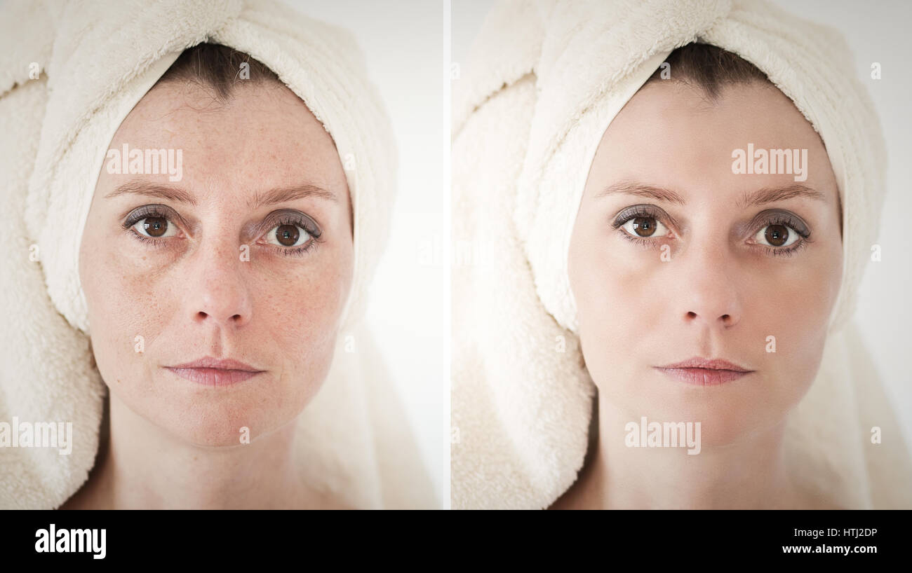 beauty concept - skin care, anti-aging procedures, rejuvenation ...