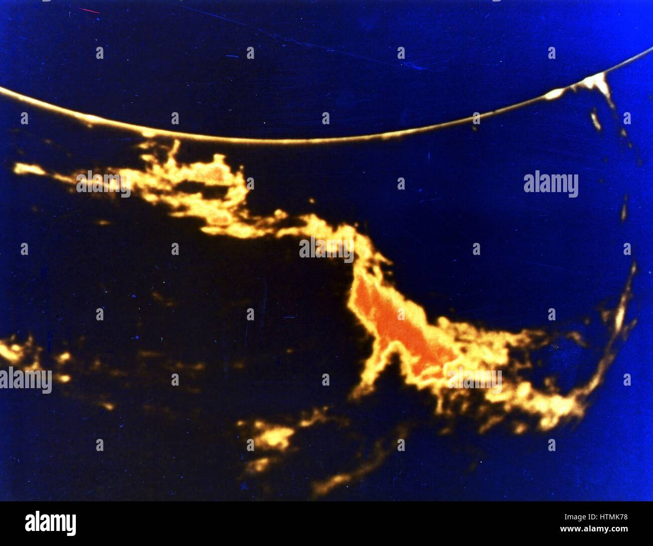 Solar flare - X-ray image. NASA photograph Stock Photo - Alamy