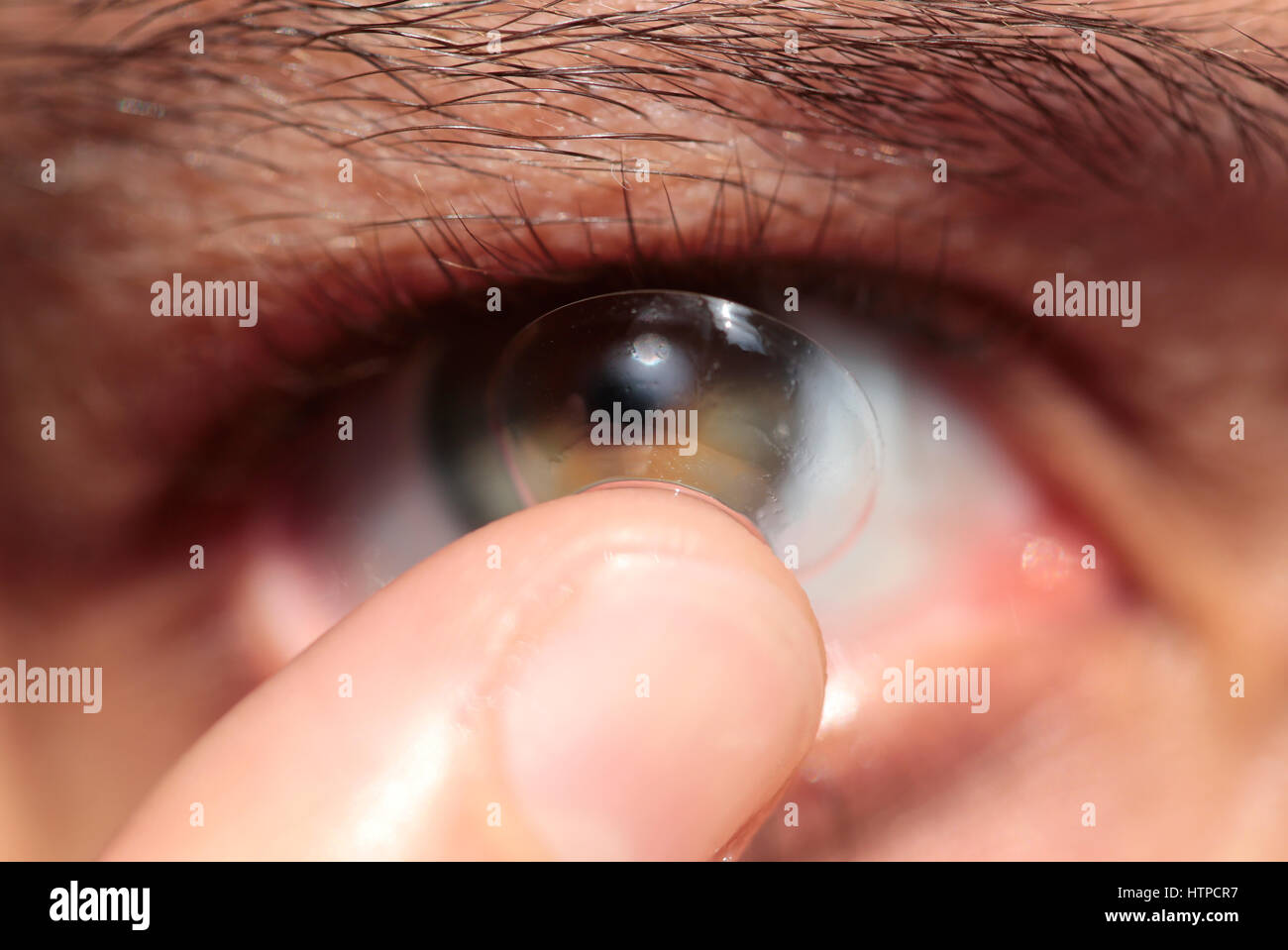 Placement of contact lenses on eye Stock Photo - Alamy